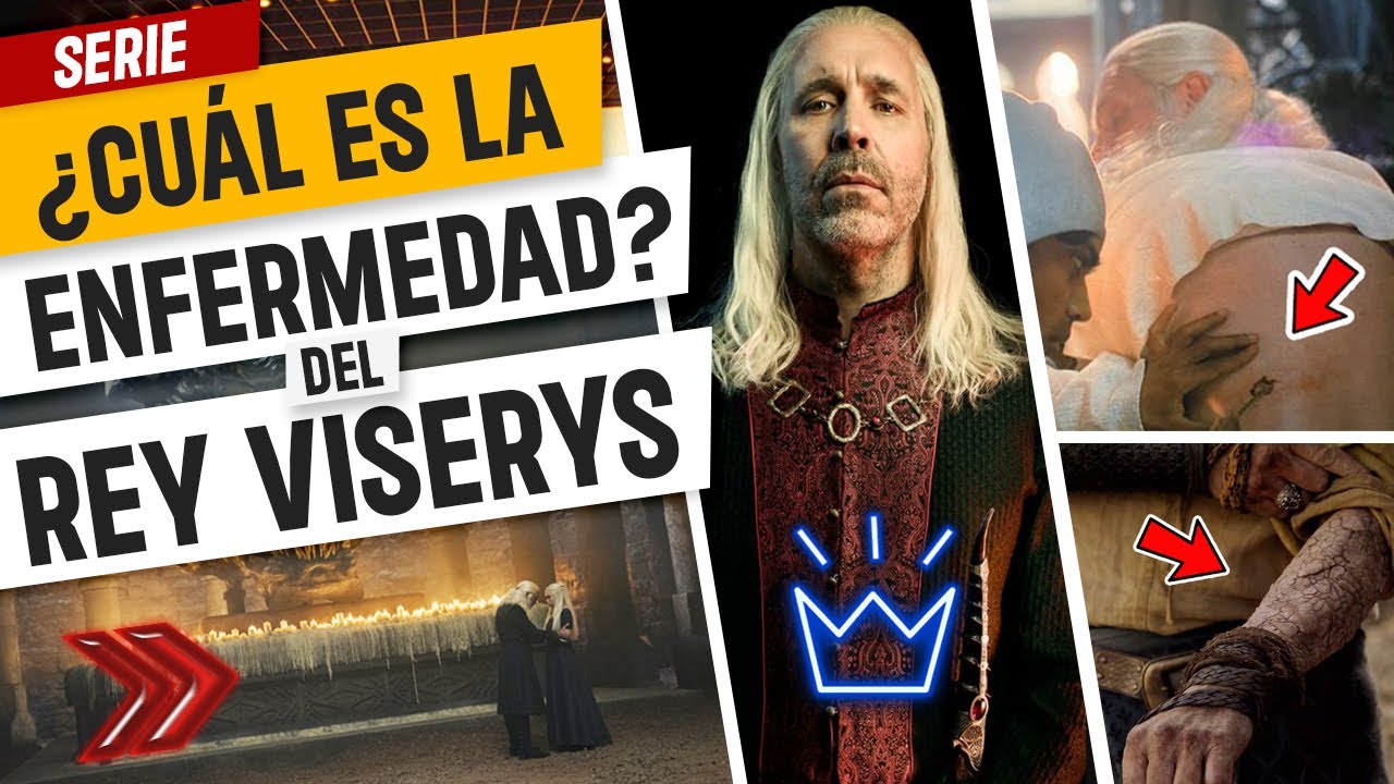 ¿Cuál es la enfermedad del REY VISERYS? | La Casa del Dragón - YouTube