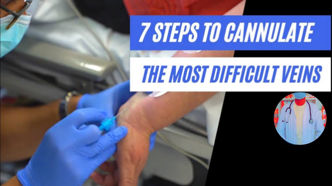 7 STEPS TO CANNULATE THE MOST DIFFICULTY VEINS! - YouTube