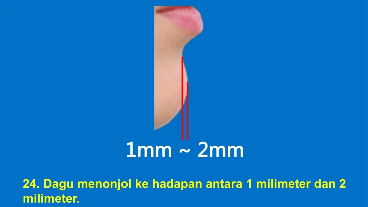 Dagu menonjol ke hadapan antara 1 milimeter dan 2 milimeter. - YouTube