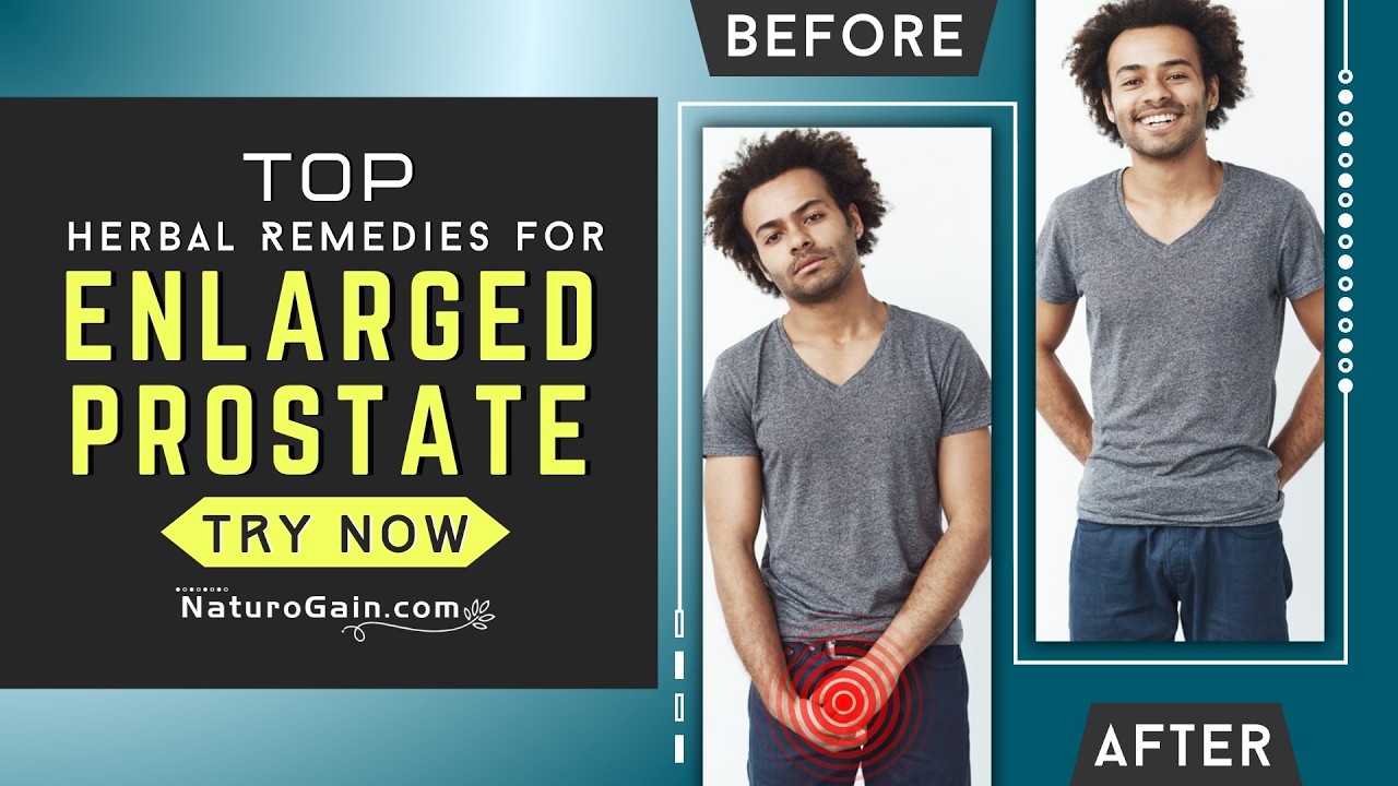 How to Fix an Enlarged Prostate Gland Naturally: Top Herbal Remedies ...