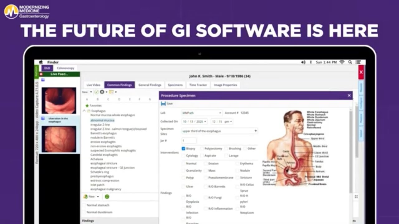Think You Know gGastro? Meet gGastro 5.0 - YouTube