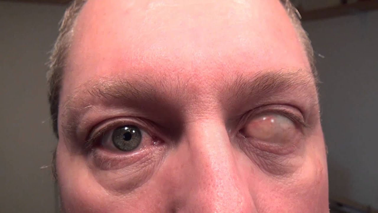 After Effects FX Interesting eye - YouTube