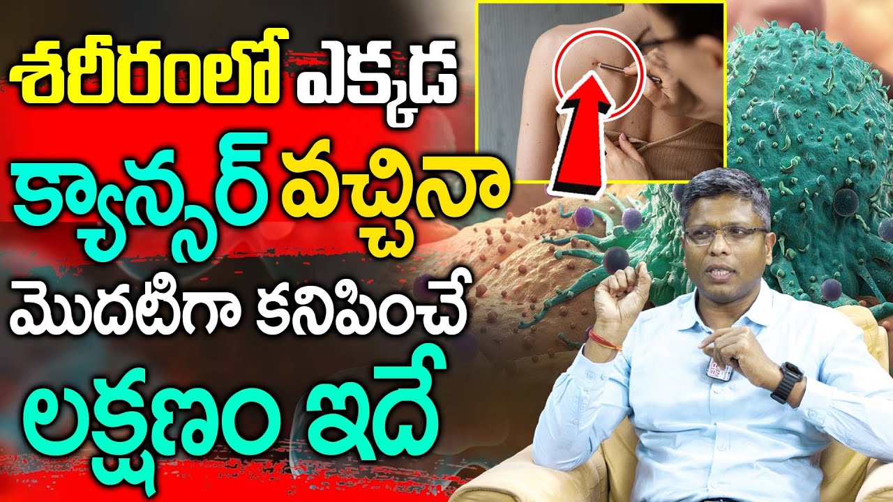 ఒంట్లో కాన్సర్ కణాలు ఉంటె కనిపించే సూచనలు || Dr.Prasanth Reddy About ...