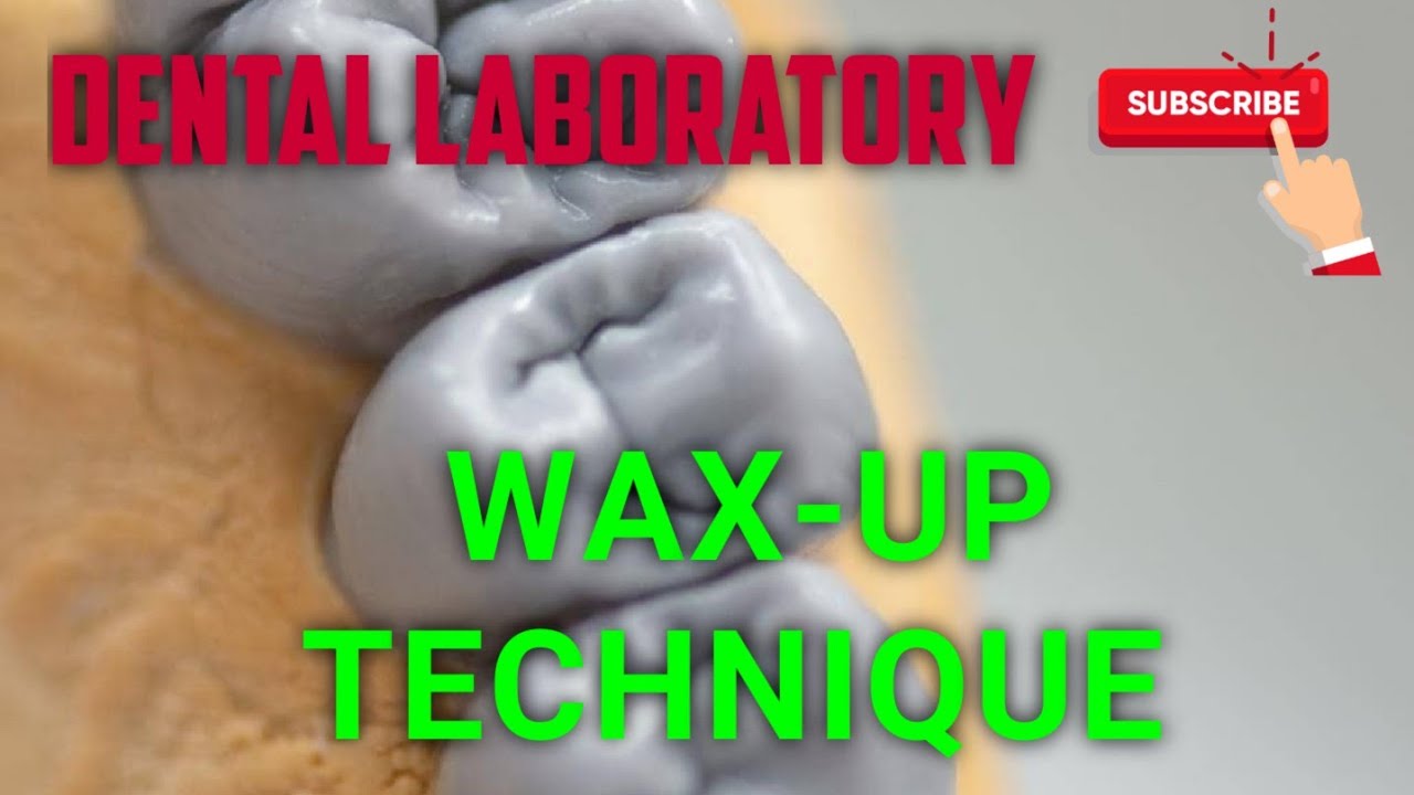 Wax up bridge technique - YouTube