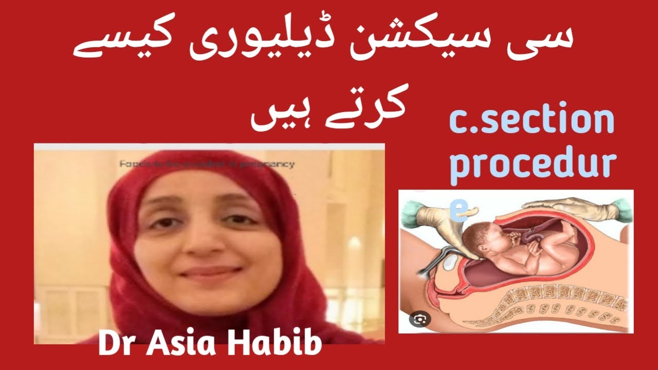 How is C section done|Cesarean delivery|Cesarean delivery me kia hota ha - YouTube