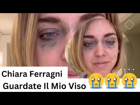 Chiara Ferragni, Guardate Il Mio Viso La Confessione #ferragnez - YouTube
