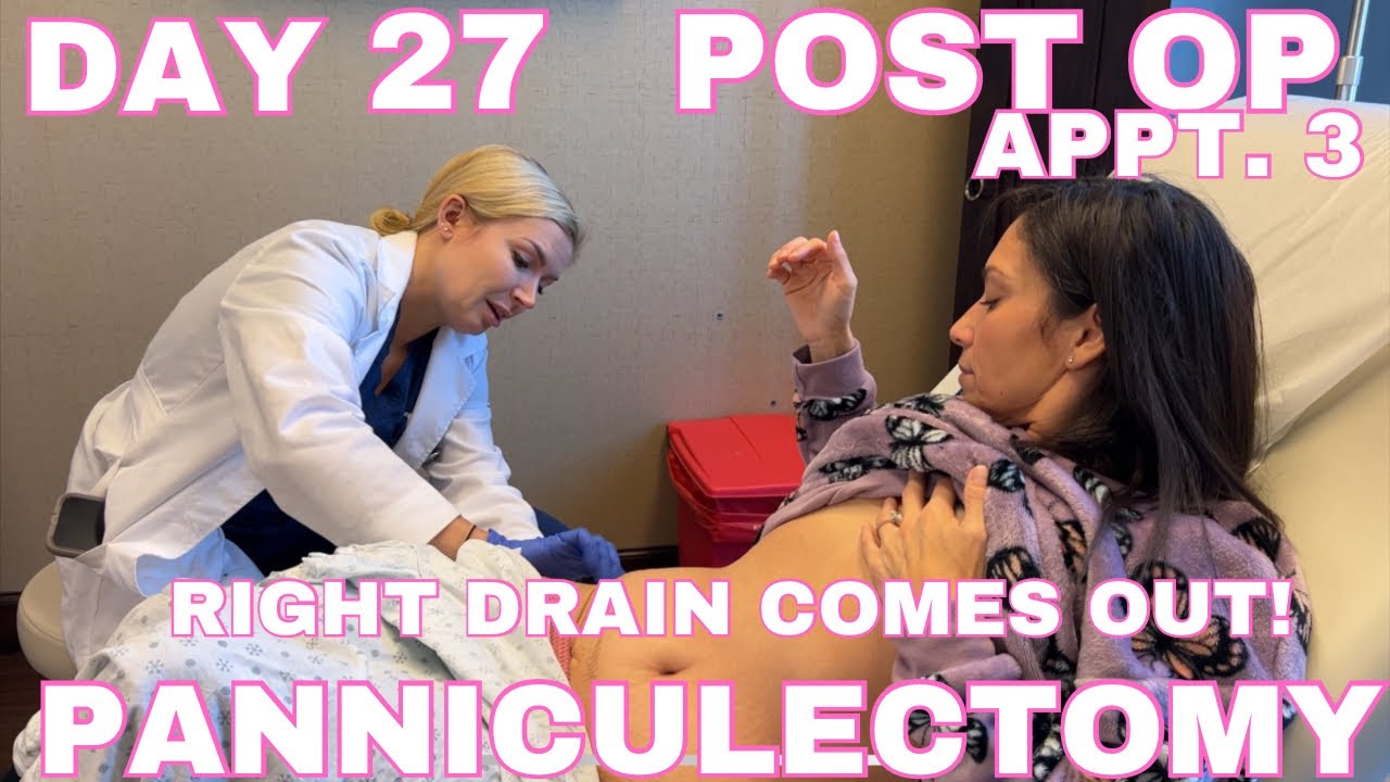 27 Days Post Op Update Bye Bye Right Drain Panniculectomy Recovery 27-days-post-op-update-bye-bye-right-drain-panniculectomy-recovery