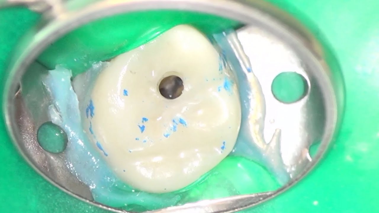 A day in the life of an Endodontist... - YouTube