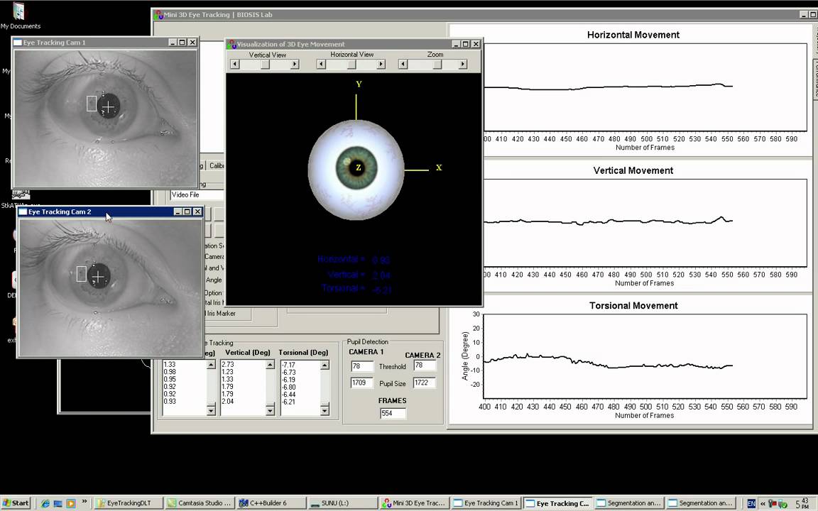 3D Video Oculography - Medical Eye Tracking - YouTube