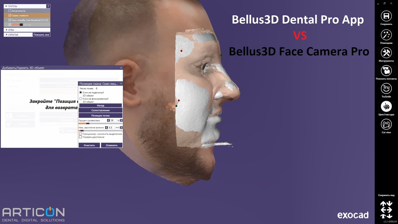 Bellus3D Dental Pro App VS Bellus3D Face Camera Pro - YouTube