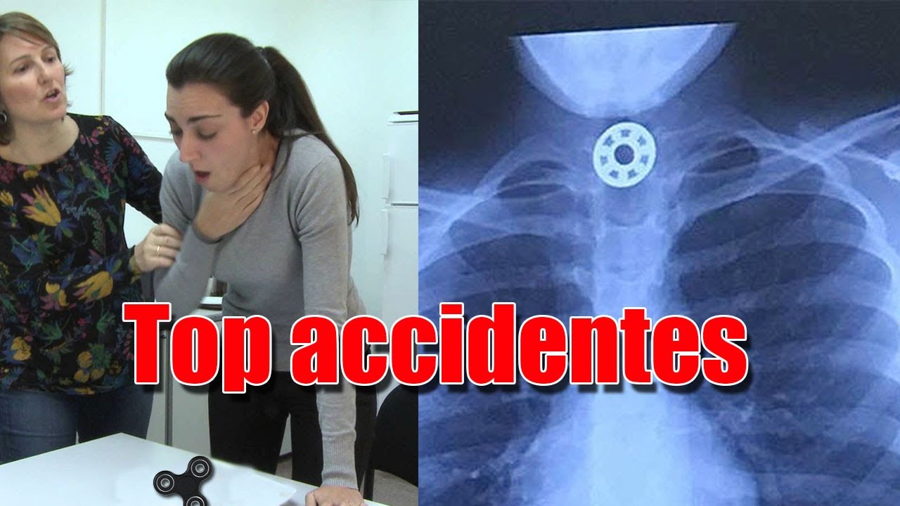 Accidentes por los fidgets spinners - YouTube