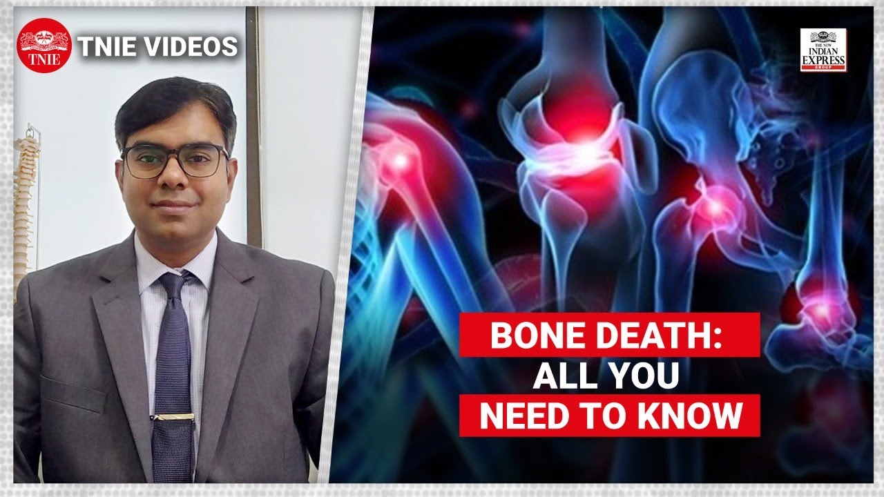 Explained: What is bone death, the latest post Covid-19 complication ...