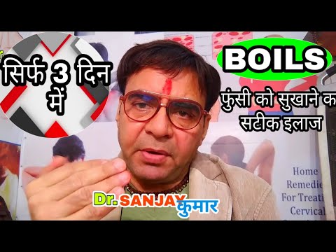 Treatment of boils - फोड़े फुंसी का इलाज | फोड़े का इलाज , Phodhe Ka ilaj