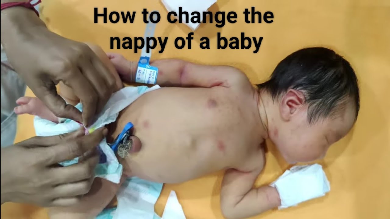PROPER METHOD TO CHANGE BABY DIAPER (#nappy change) - to prevent ...