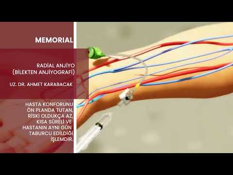 Radial anjiyografi (el bileğinden anjiyo) nedir? - Uz. Dr. Ahmet Karabacak (Kardiyoloji)