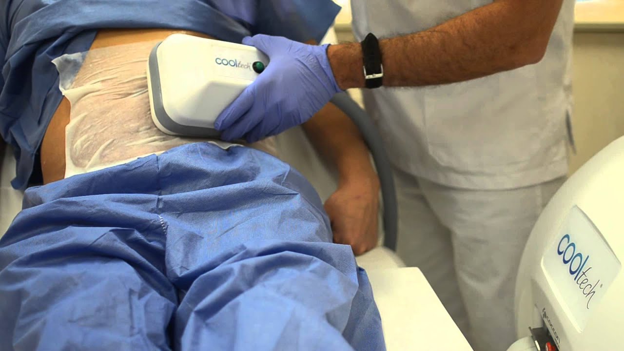 CoolTech video treatment - YouTube