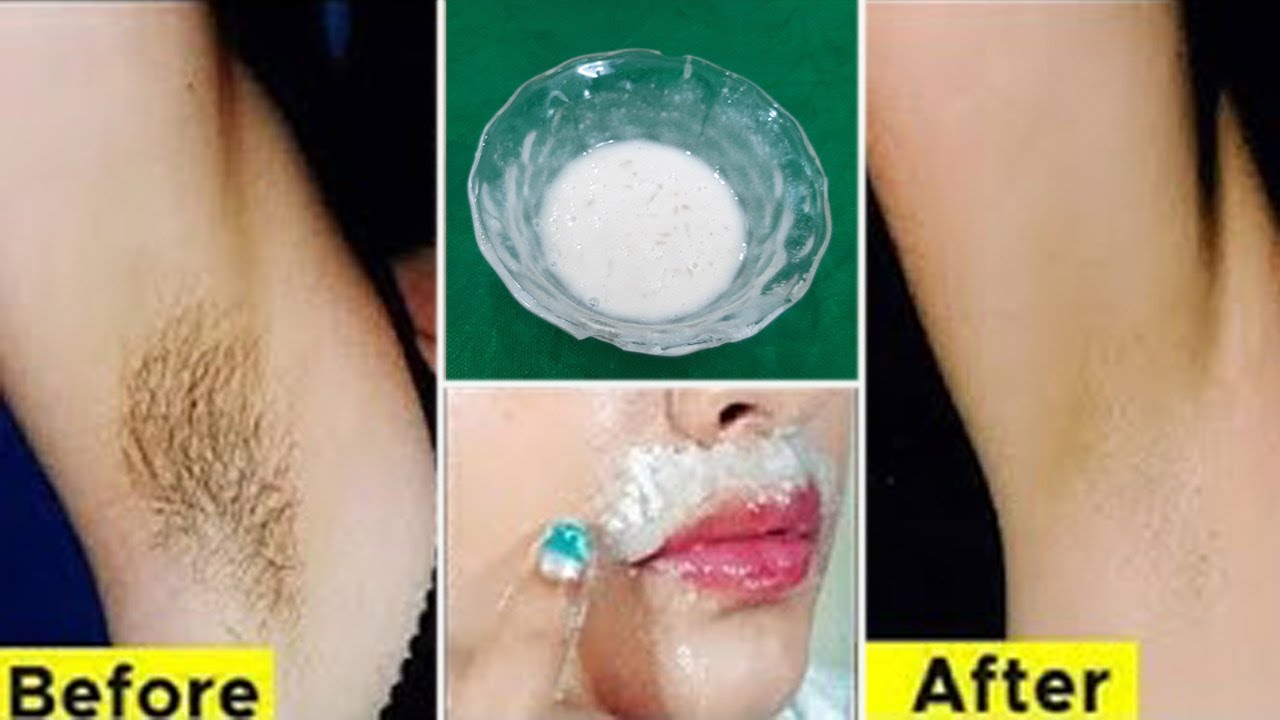 Painless unwanted Hair Removal In Just 5 Minutes With Natural Home ...