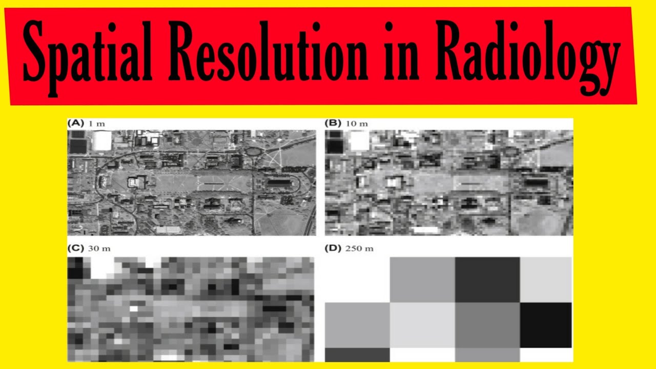 Spatial Resolution in Radiology | CT Spatial Resolution in Hindi ...