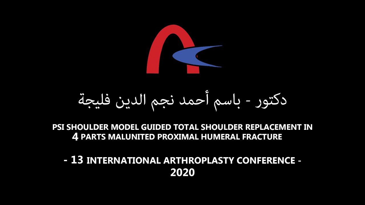PSI SHOULDER MODEL GUIDED TOTAL SHOULDER REPLACEMENT IN 4 PARTS ...