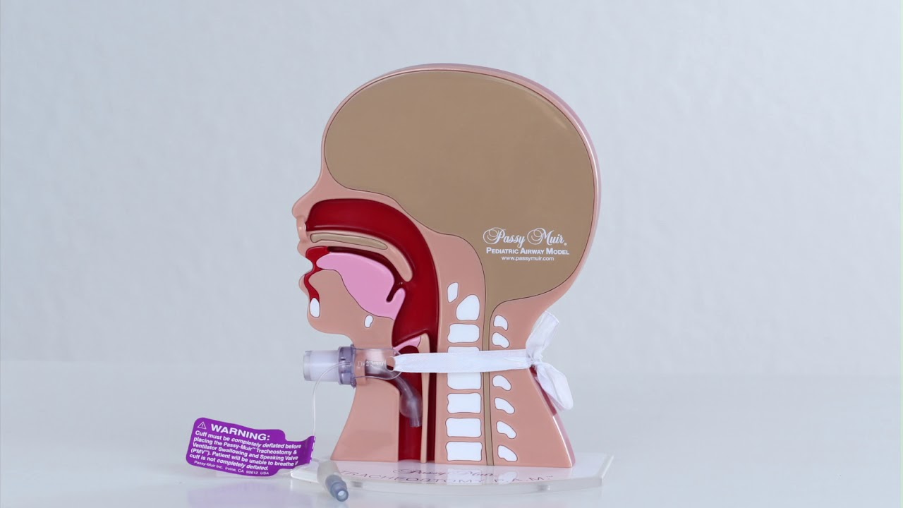 Tracheostomy PAM: Cuff Over Inflation - YouTube