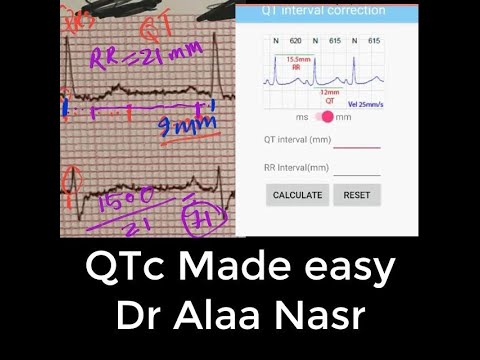 QTc Made easy - YouTube