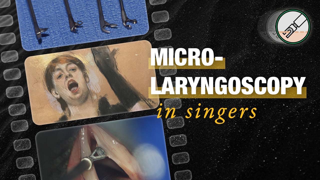 Vocal Cord Microsurgery in Singers Should No Longer Be Controversial ...