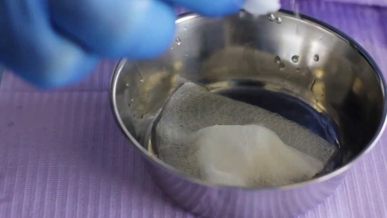 How to Prepare the Puncture Site Aseptically for Routine Venipuncture ...