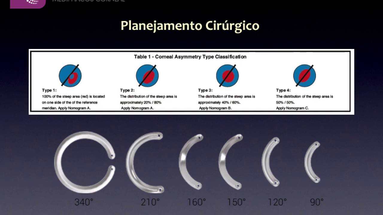 Introdução ao Keraring AS: Mediphacos - YouTube
