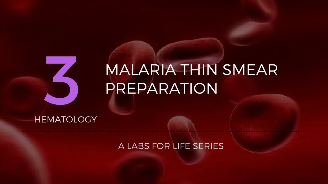 Malaria Thin Smear Preparation - YouTube