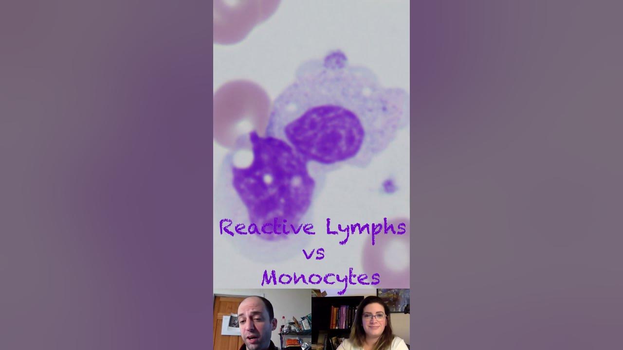 Reactive Lymphocytes Versus Monocytes Youtube