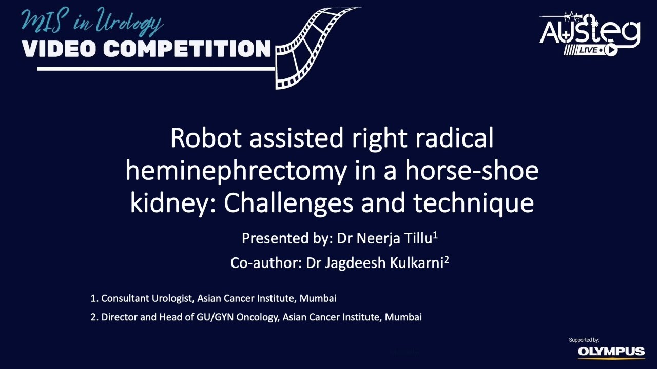 Robot Assisted Right Radical Hemi-Nephrectomy in A Horse-Shoe Kidney ...