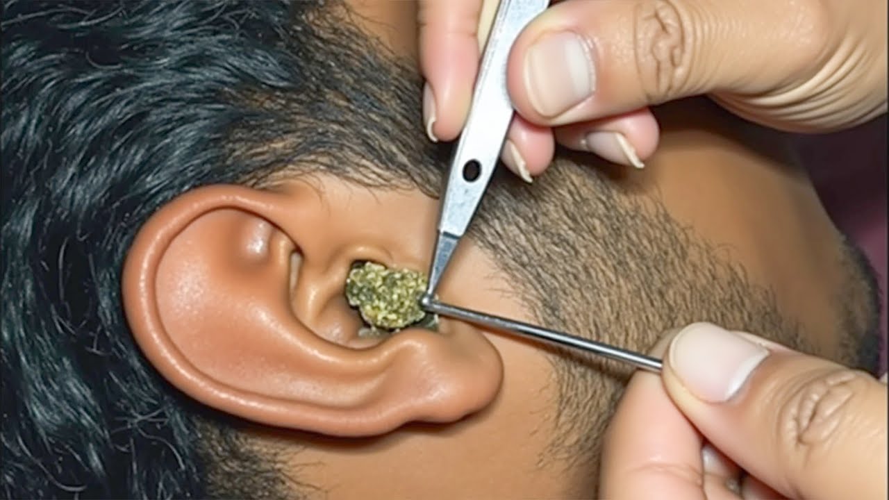 ASMR EAR "ASMR Ear Cleaning Sound | Relaxing & Satisfying Ear Wax ...