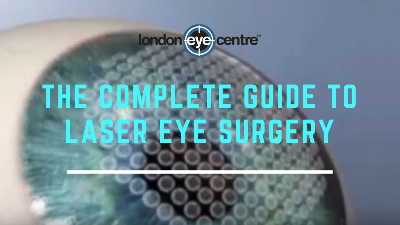 The Complete Guide To Laser Eye Surgery - YouTube
