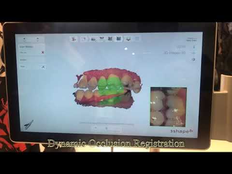 IDS 2019 - TRIOS Patient Specific Motion - YouTube