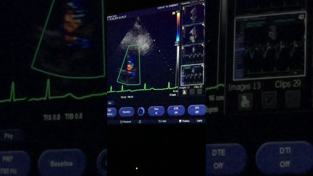 A5C part 2 - YouTube