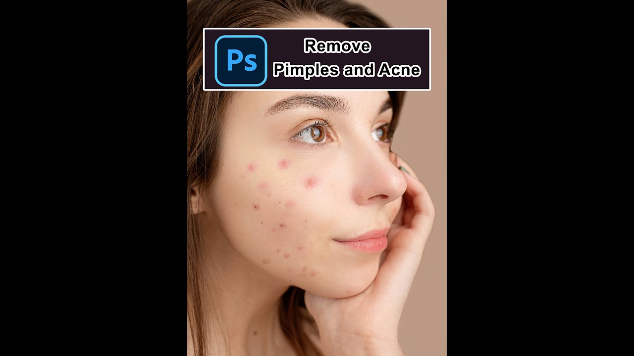 Remove Pimples and Acne# Photoshop # tutorial # beginners # ps - YouTube