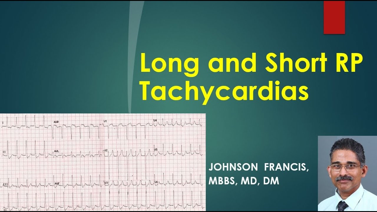 Long and Short RP Tachycardias - YouTube Long and Short RP Tachycardias - YouTube