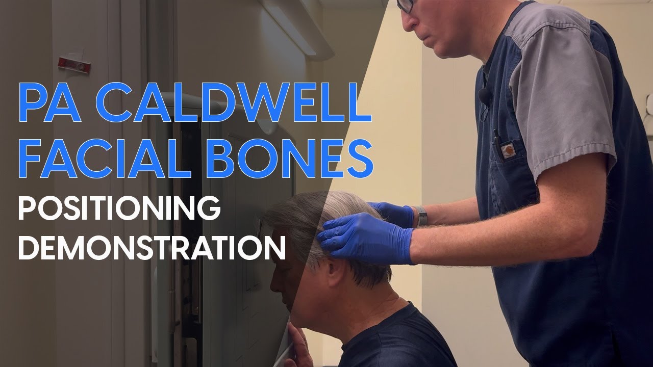 PA Caldwell Facial Bones Radiographic Positioning Demonstration - YouTube