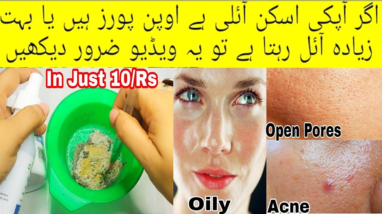 Open Pores, Acne & Oil Control Daily Skincare Routine 100% Working ...
