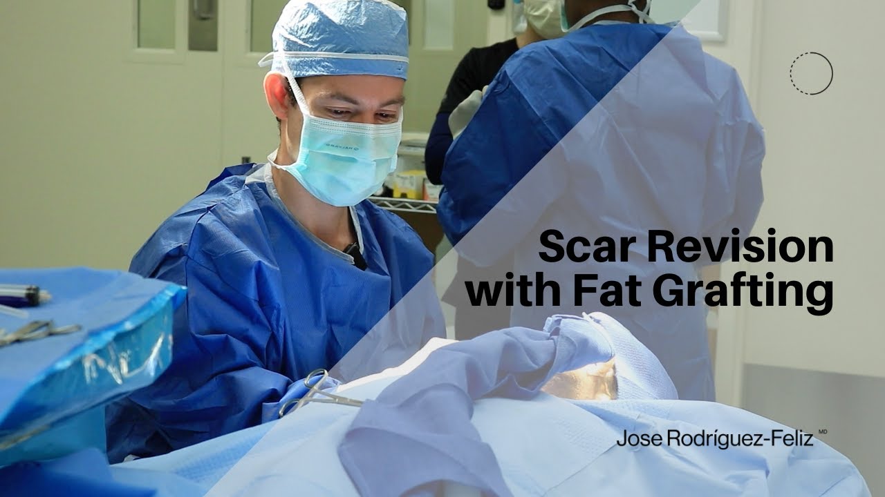 Scar Revision with Fat Grafting - YouTube