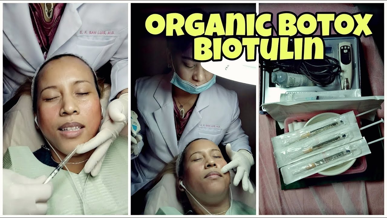 Organic Botox best! BIOTULIN with FNT treatment review - YouTube