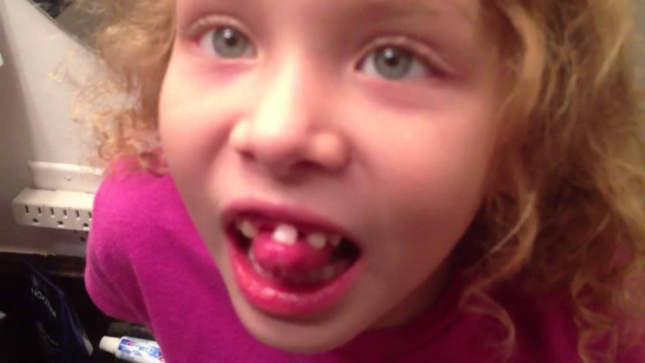 Screaming tooth extraction - YouTube