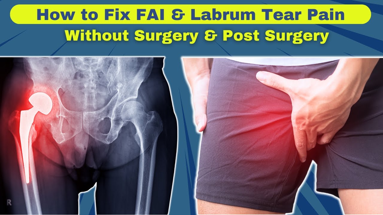 How to Fix FAI & Labrum Tear Pain without Surgery & Post Surgery - YouTube