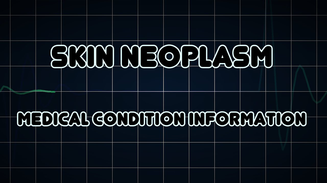 Skin Neoplasm (Medical Condition) - YouTube