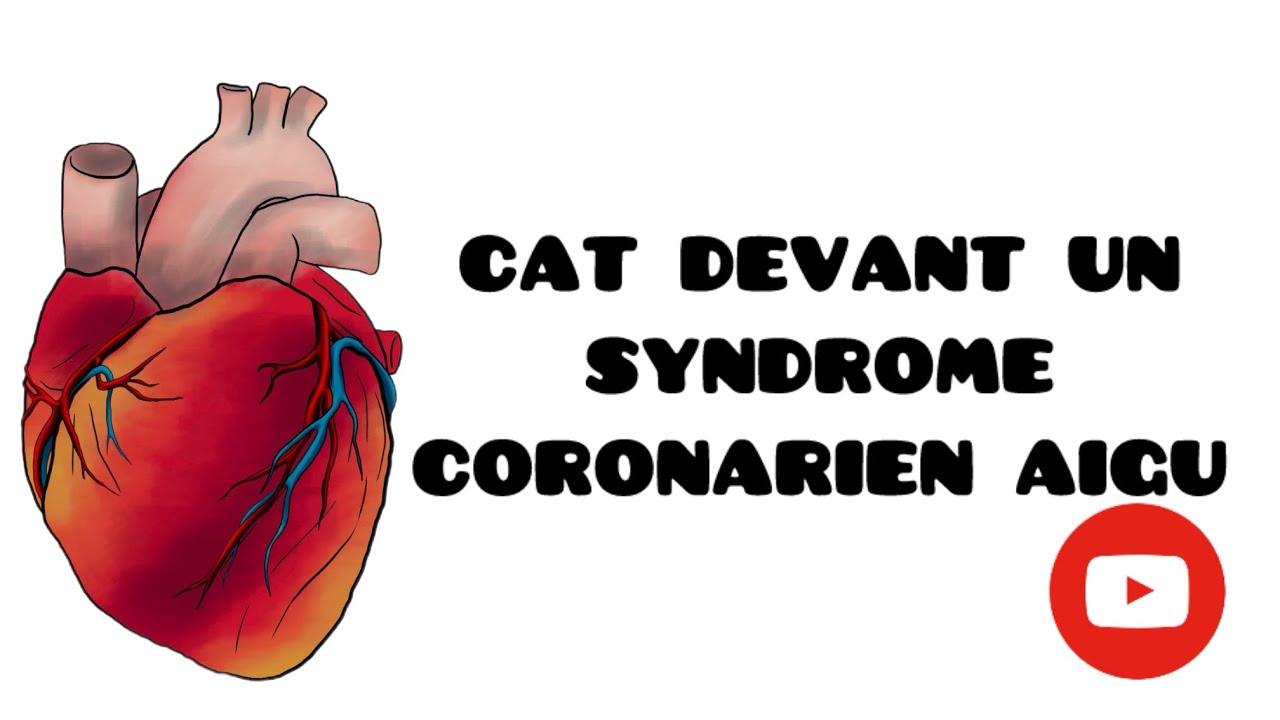 CAT ( Conduite à tenir ) devant un syndrome coronarien aigu ( SCA ...