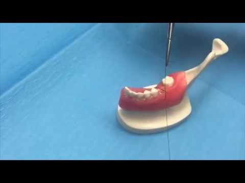Extraction Socket Grafts and Suturing Recommendation - YouTube