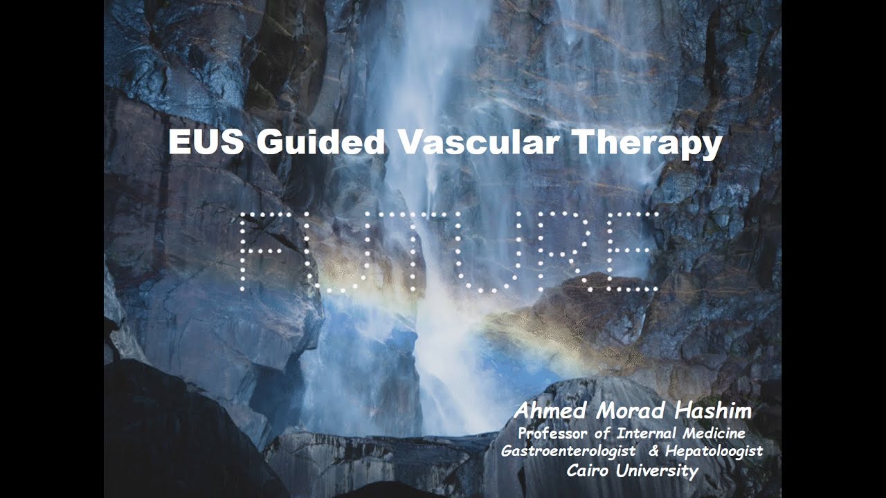 Role of EUS in Vascular intervention - YouTube