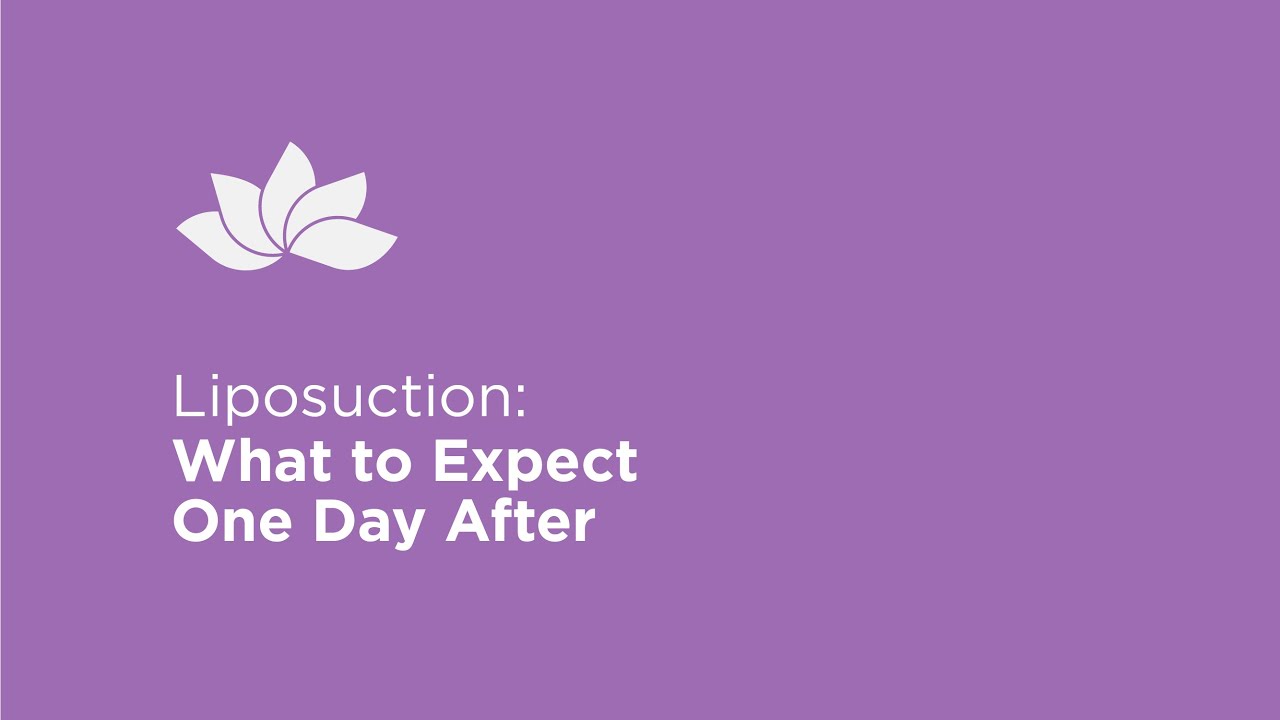 One Day After Liposuction - What To Expect | Plastic Surgeon Explains ...