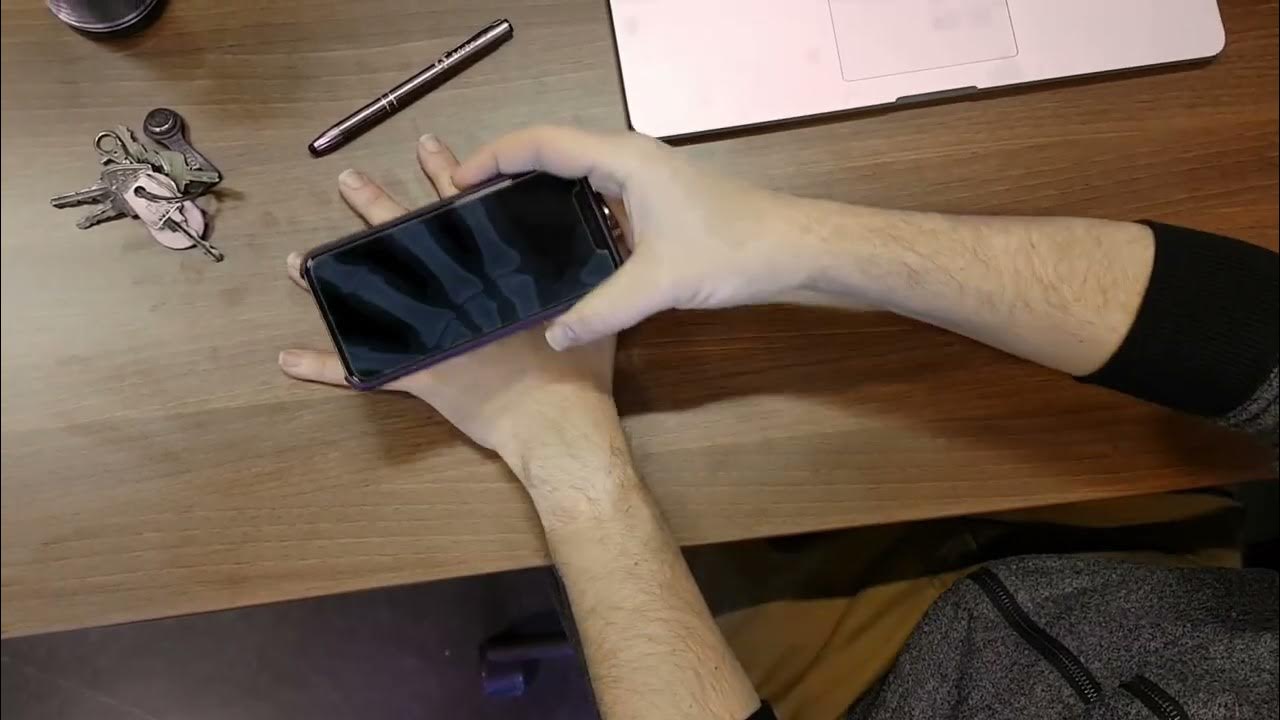 Xray Hand Youtube