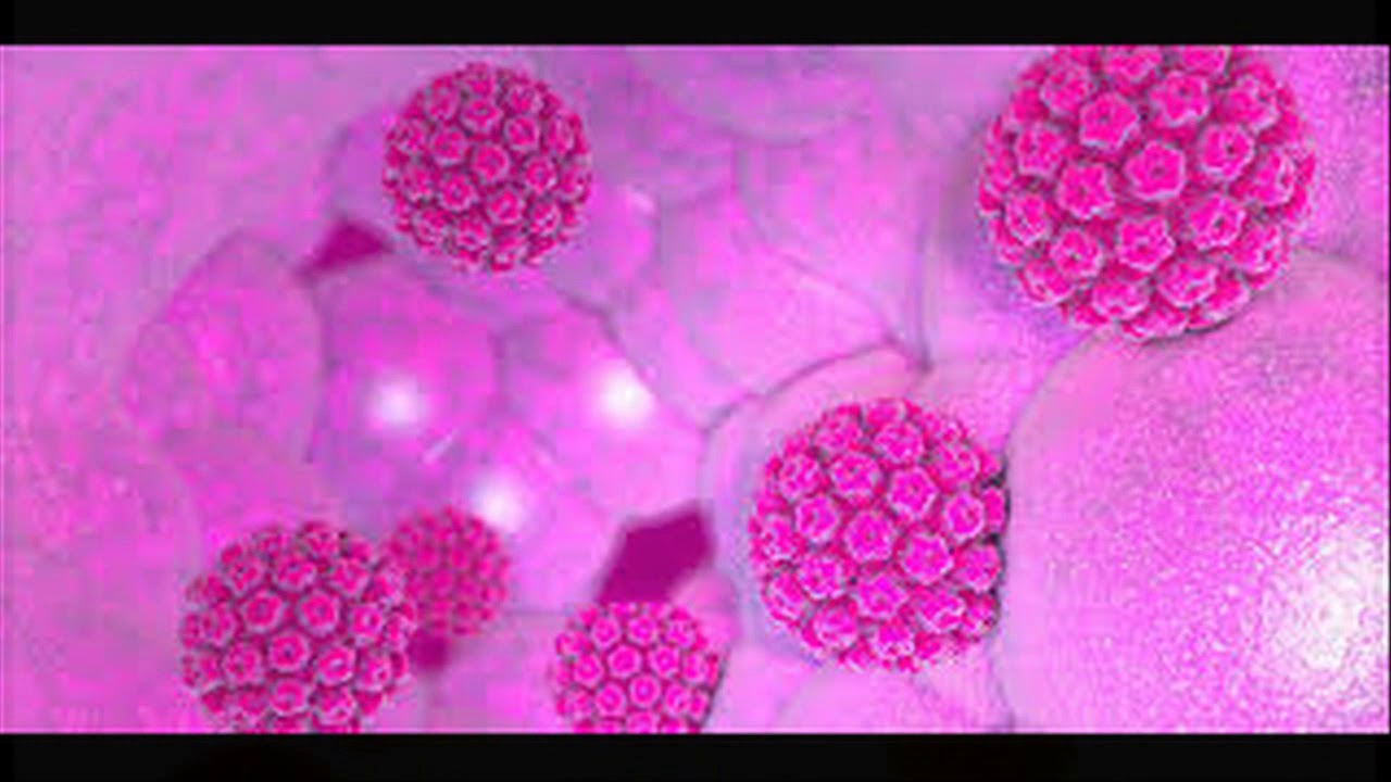Human Pappiloma Virus Healing Rife - YouTube